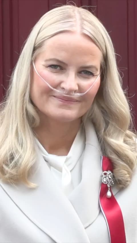 Lunge­transplantasjon: –⁠ Siste utvei - VG